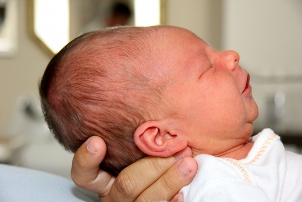 Newborn’s Head Shape | Should You Be Concerned?