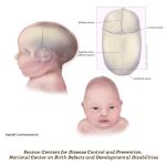 Baby & Newborn Head Shape: What's Normal and When to Worry