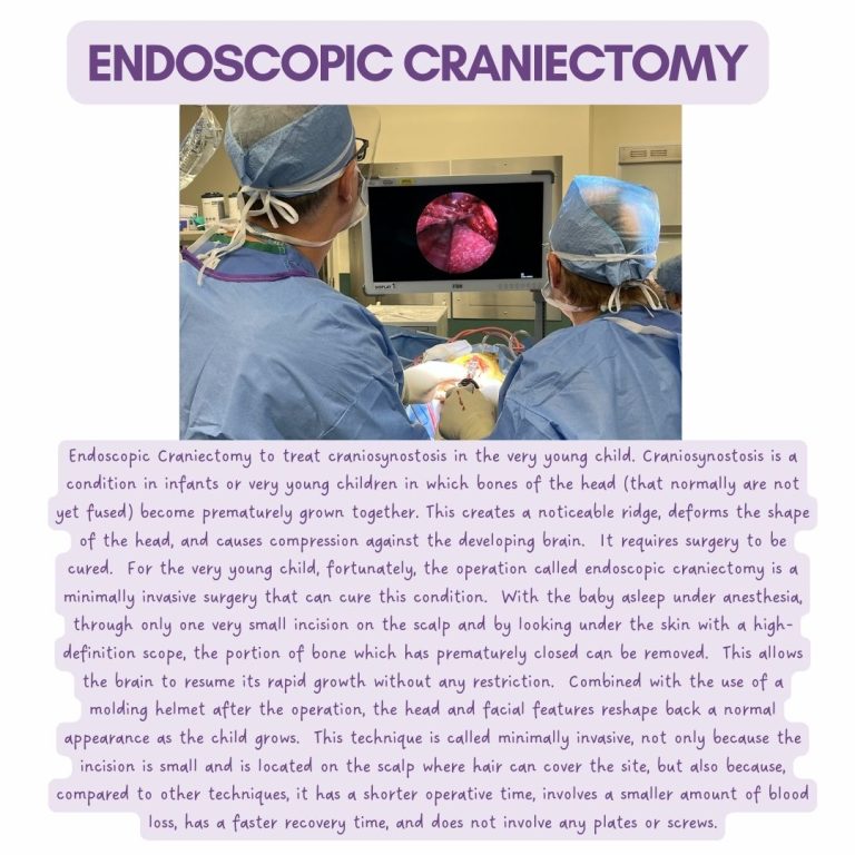 Endoscopic Craniectomy Learn New Procedure Today - NJ Craniofacial ...