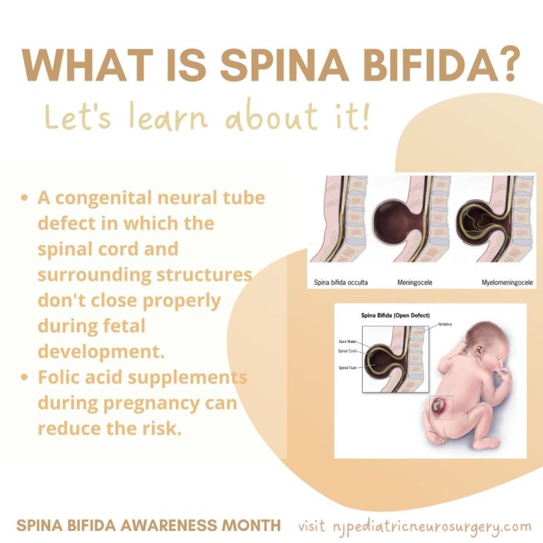 What Is Spina Bifida? - NJ Craniofacial Center's